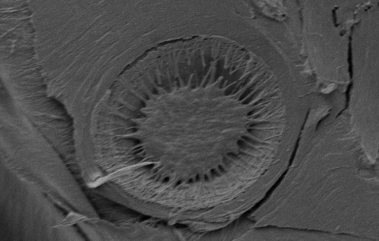 Development of low cost water filters using plant xylem – MIT Tata Center